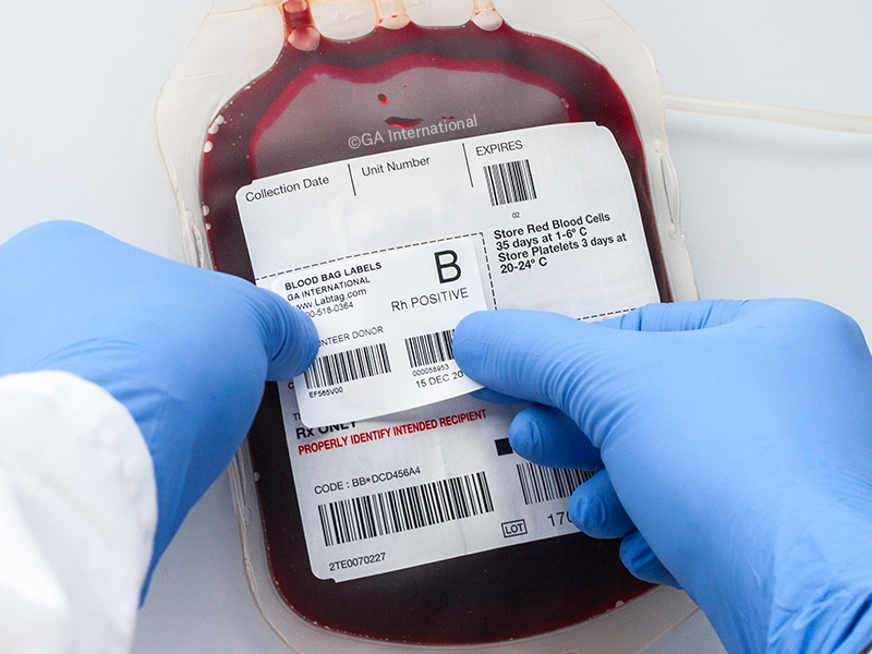 Blood Bag Secondary Labels 2 X 1 5 H FJT 14 LabTAG Laboratory Labels
